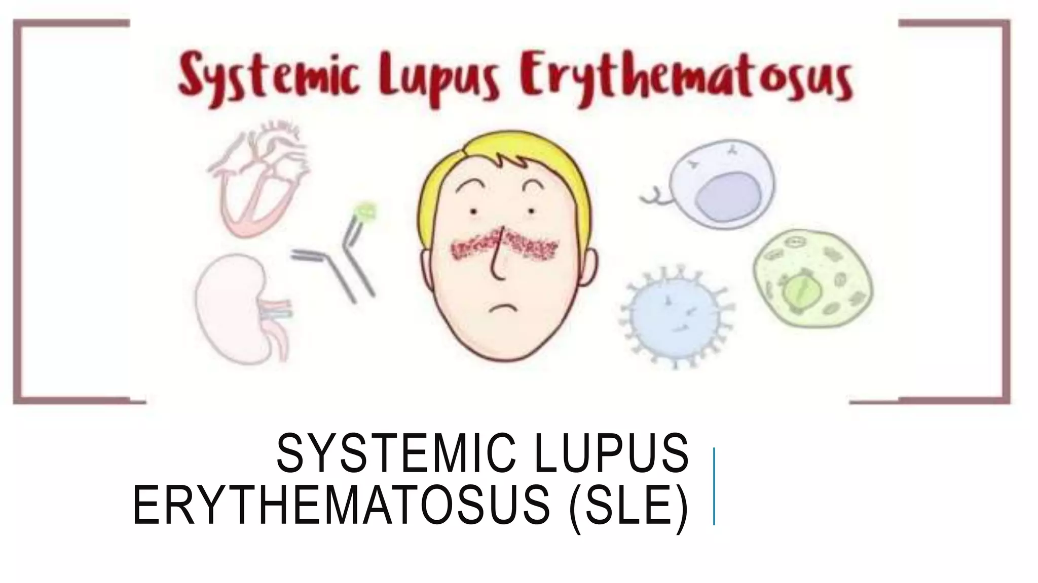 Systemic lupus erythematosus (sle) | PPTX