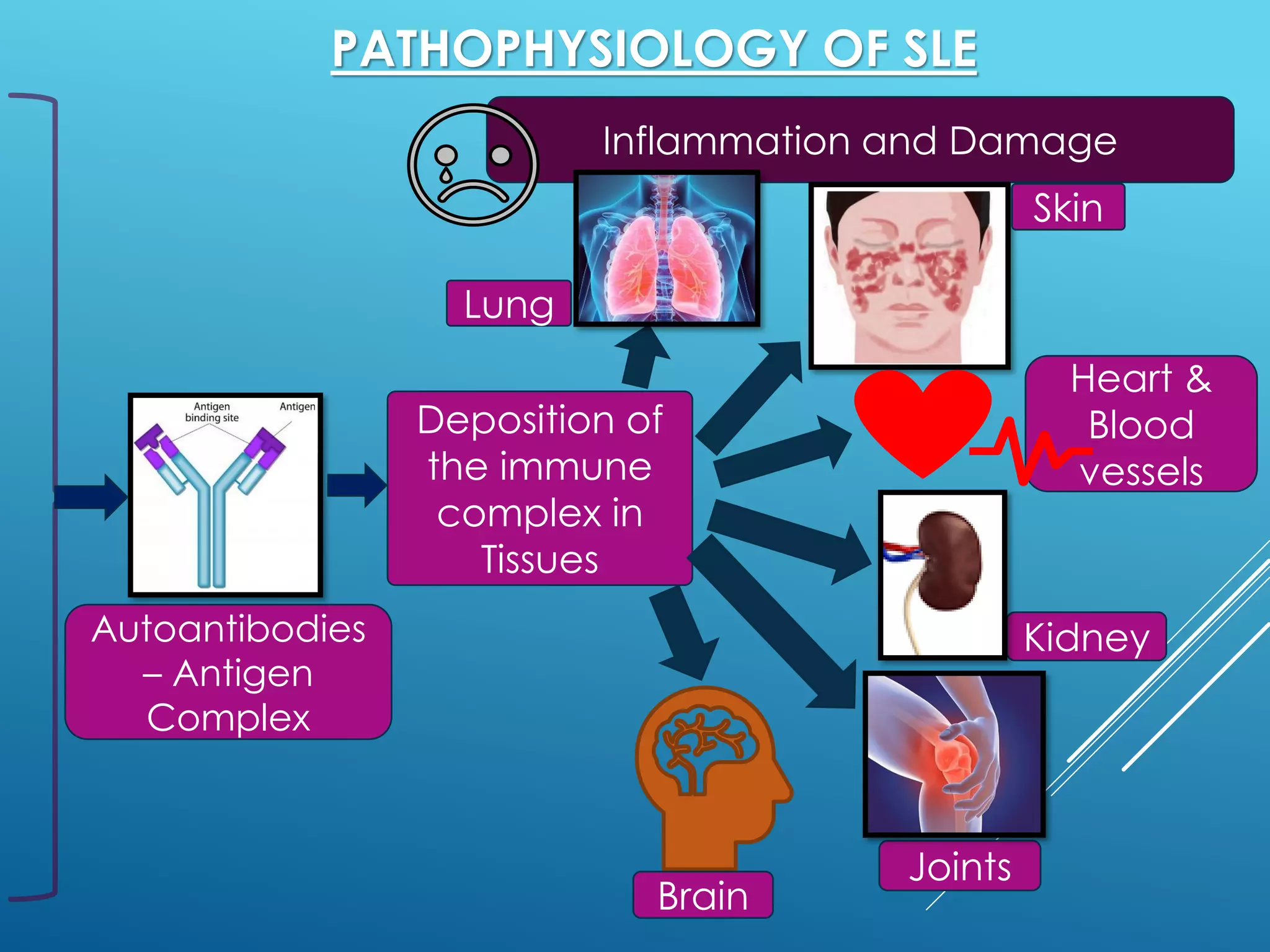 Systemic Lupus Erythematosus (SLE) | PDF