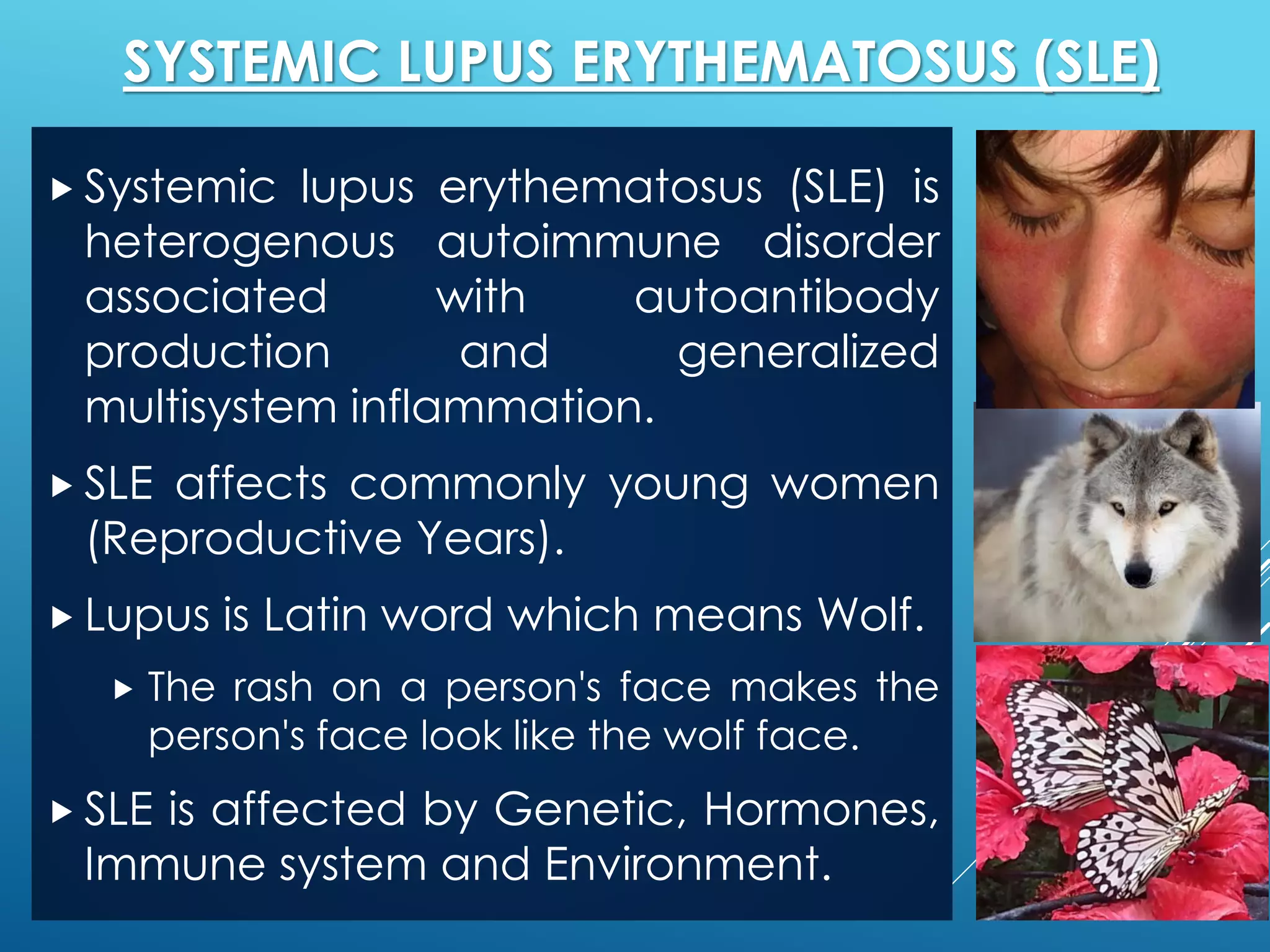 Systemic Lupus Erythematosus (SLE) | PDF