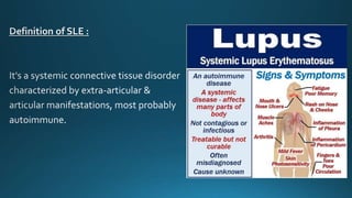 Systemic Lupus Erythromatosus (SLE).PPTX