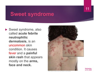 systemic manifestations of IBD.ppt