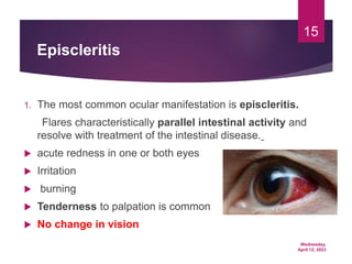 systemic manifestations of IBD.ppt