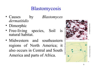 Systemic mycose | PPT