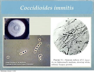 Coccidioides Immitis Culture