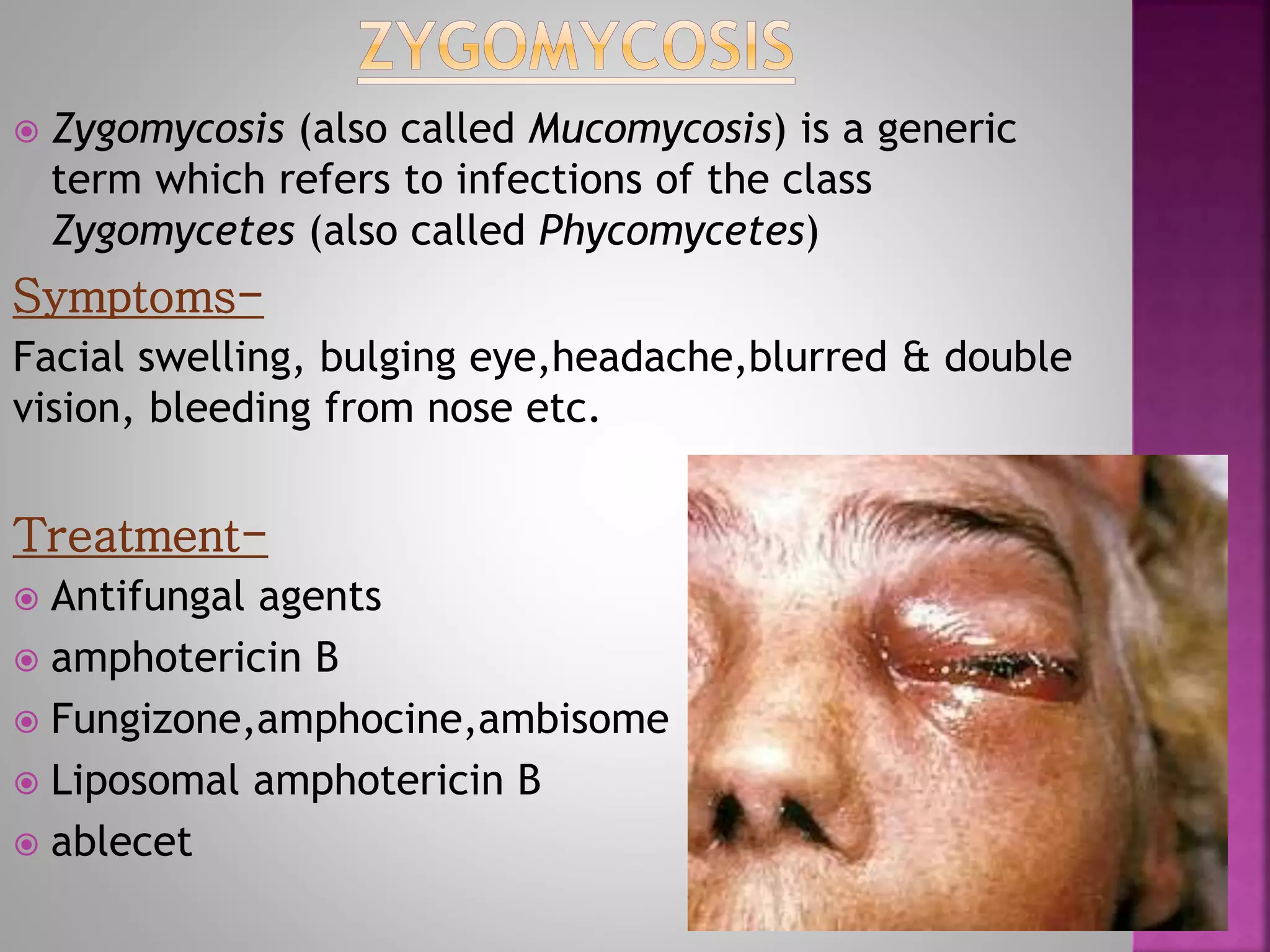 Systemic Mycoses | PPTX
