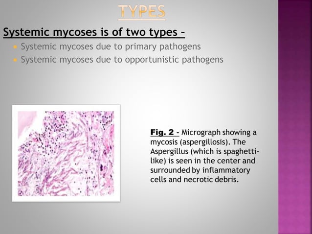 Systemic Mycoses | PPTX
