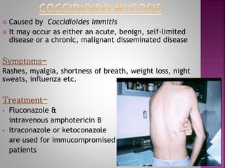 Systemic Mycoses | PPTX