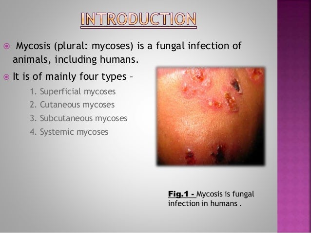 Systemic Mycoses