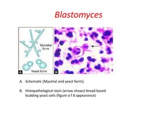 Systemic mycoses | PPT