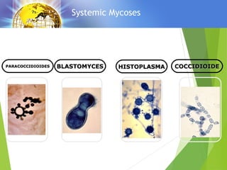 Systemic mycoses m | PPT