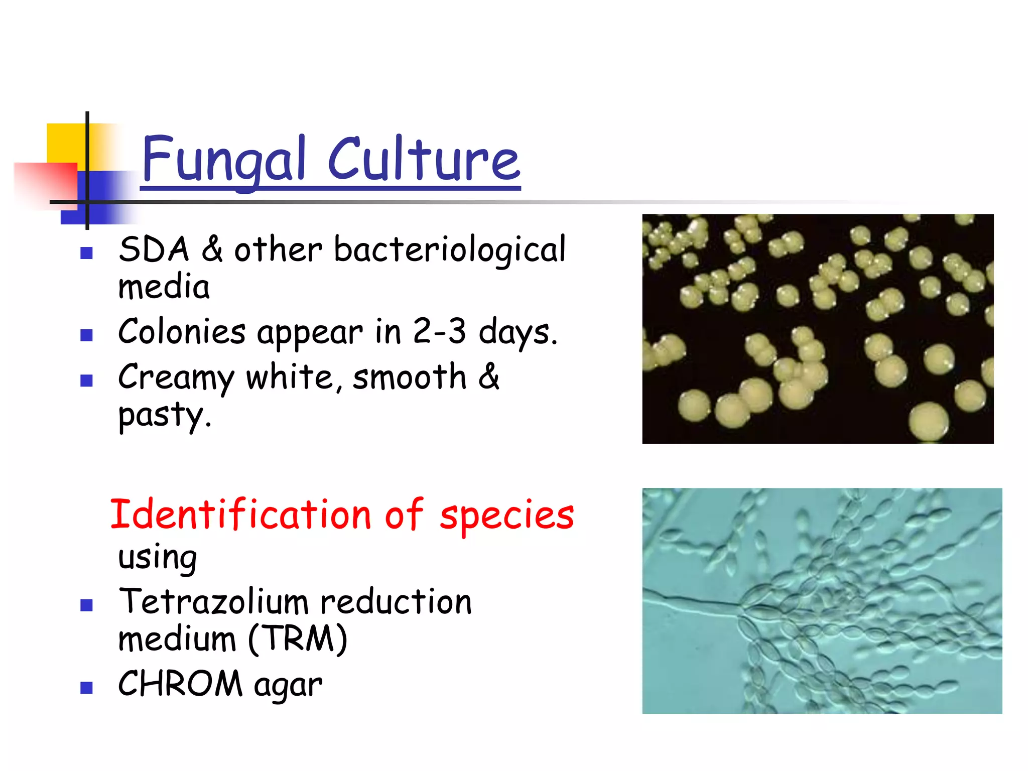 Systemic mycosis | PPT