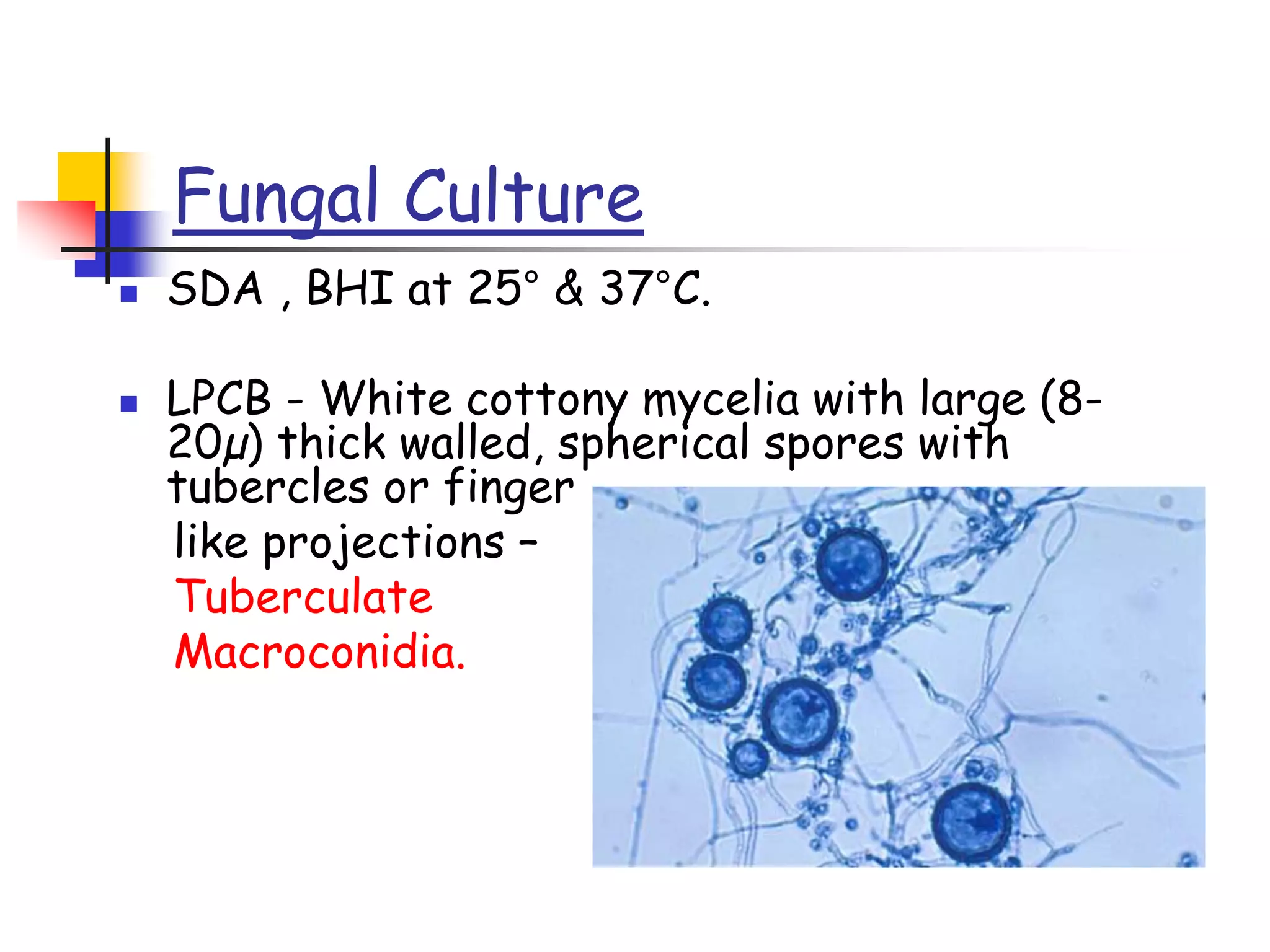 Systemic mycosis | PPT