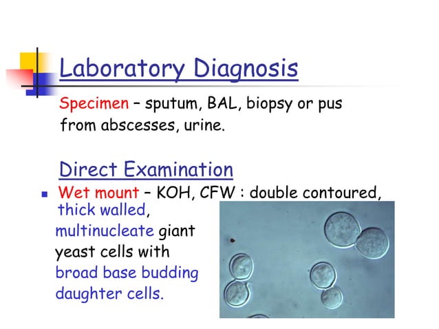Systemic mycosis | PPT | Infectious Diseases | Diseases and Conditions