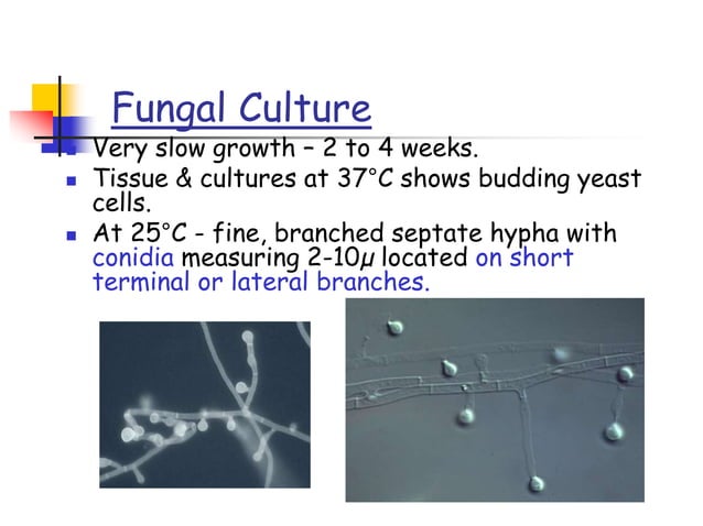 Systemic mycosis | PPT | Infectious Diseases | Diseases and Conditions