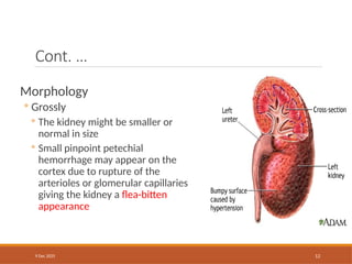Systemic pathology of Hypertensive renal disease | PPTX