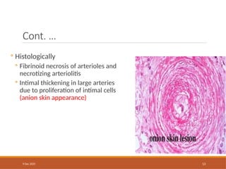 Systemic pathology of Hypertensive renal disease | PPTX
