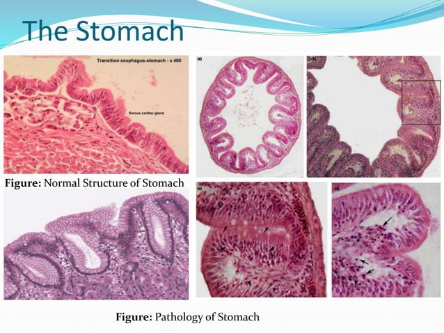 Systemic Pathology of Digestive System of Fish | PPTX