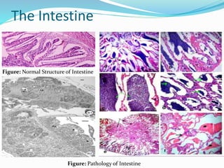 Systemic Pathology of Digestive System of Fish | PPTX