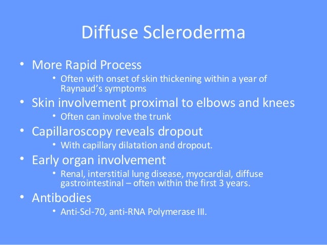 Systemic sclerosis