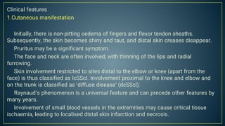 Systemic sclerosis in details & information.pdf