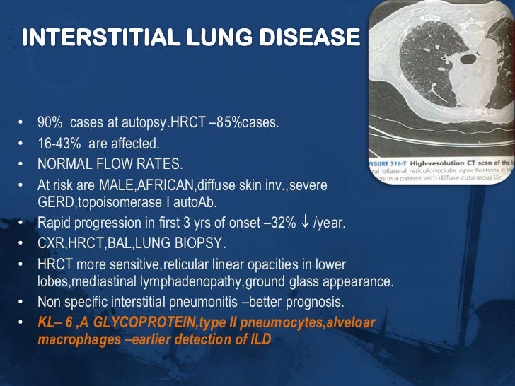 Systemic sclerosis..scleroderma