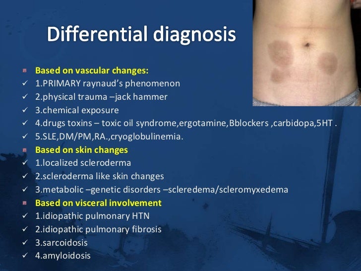 Systemic sclerosis..scleroderma