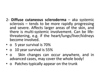 Systemic sclerosis by kanwal fatima | PPTX