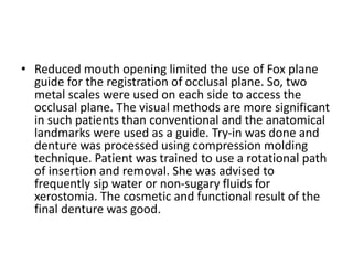 Systemic sclerosis by kanwal fatima | PPTX