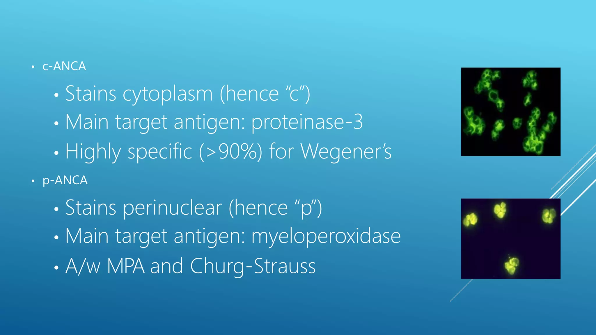 Systemic vasculitides - Wegener's Granulomatosis, Microscopic ...