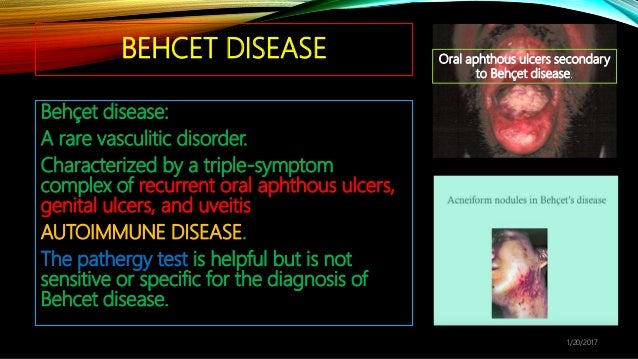 Systemic vasculitis 2016 shj