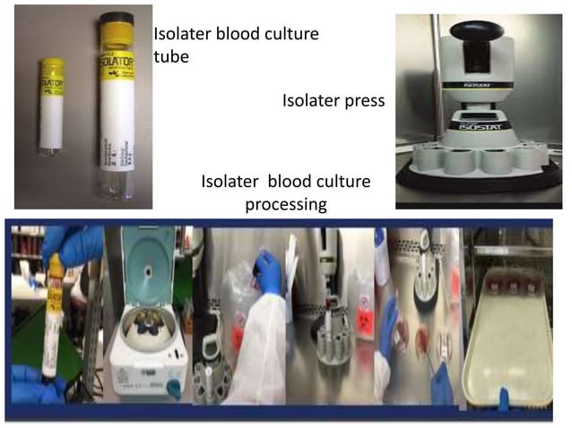 systems for processing blood cultures.pptx | Blood Disorders | Diseases ...