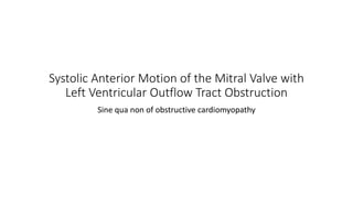 Systolic Anterior Motion Of The Mitral Valve – KIRC