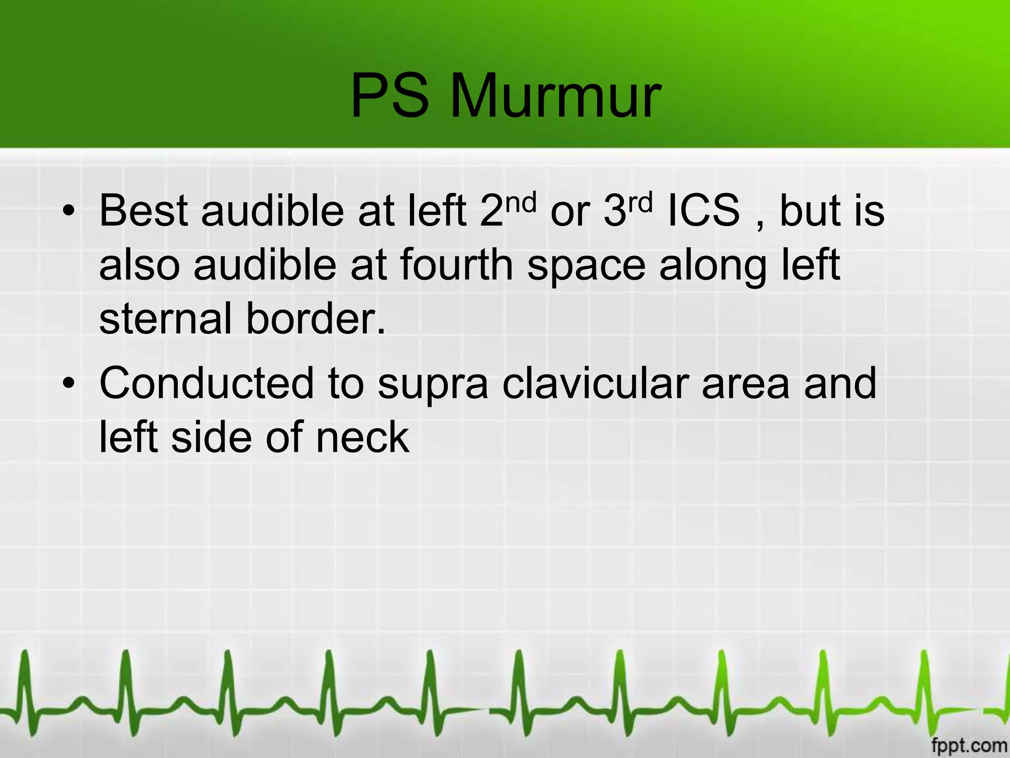 Systolic murmurs | PPTX