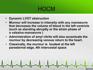 Systolic murmurs | PPTX