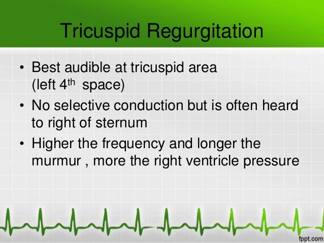 Systolic murmurs