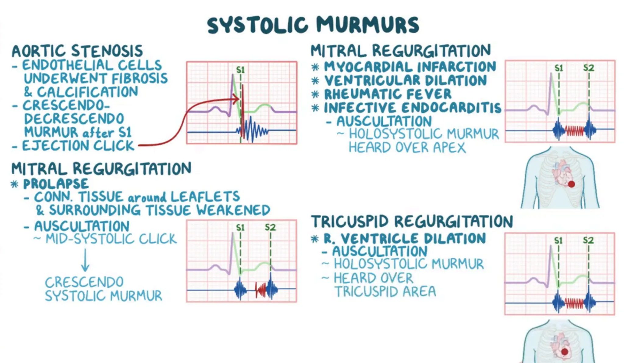 Systolic Murmurs Heart auscultations differential | PDF