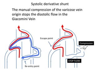 Systolic shunt | PPTX