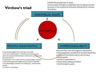 Deep vein thrombosis maria | PPT