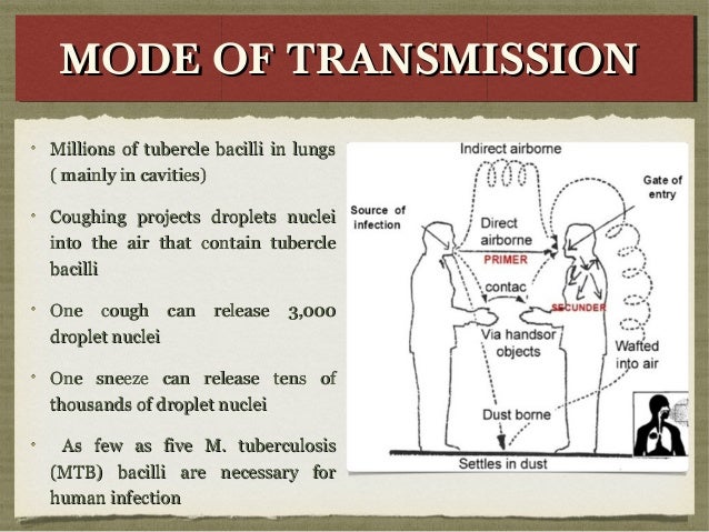 Pulmonary Tuberculosis