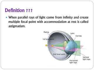 Astigmatism correction | PPTX
