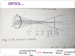 Astigmatism correction | PPT