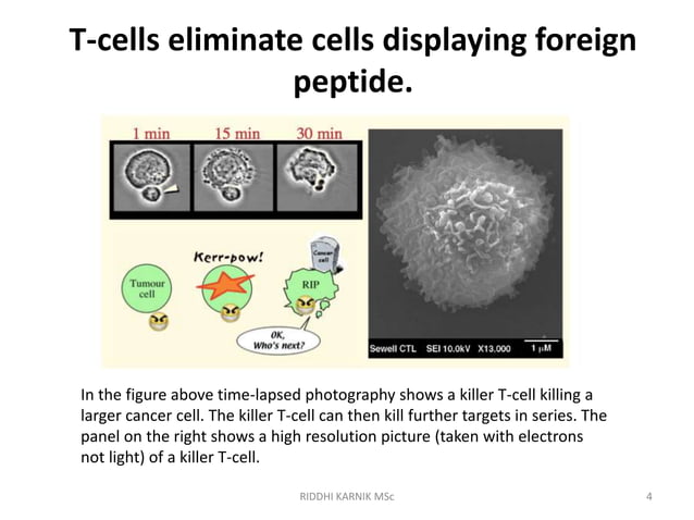 T cell lymphomas ppt | PPTX | Thyroid Disorders | Endocrine and ...