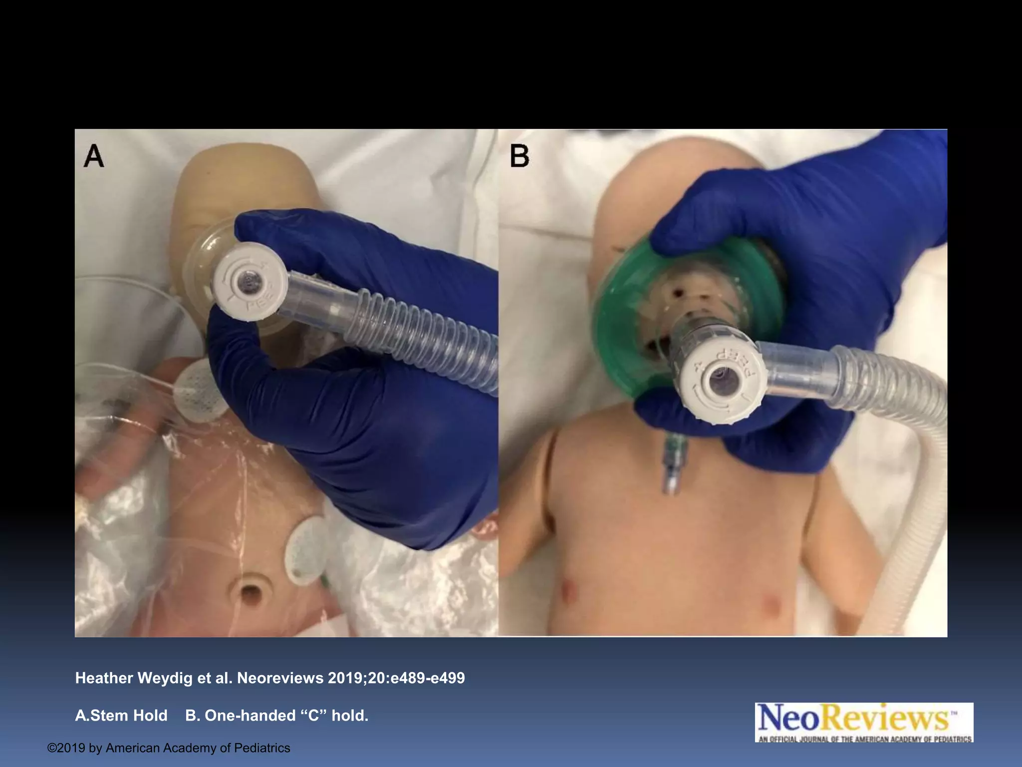 T piece resuscitator | PPTX