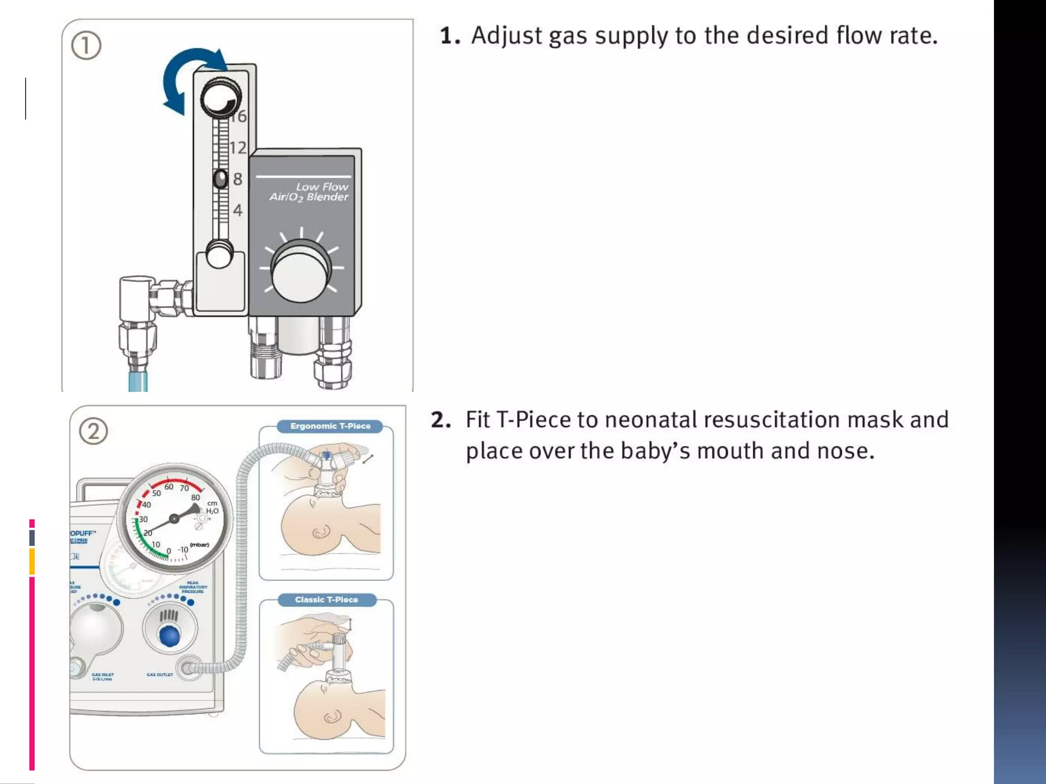 T piece resuscitator | PPTX
