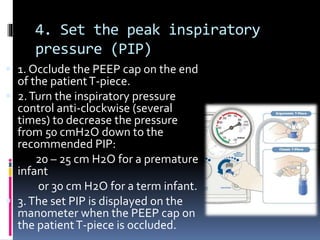 T piece resuscitator | PPTX