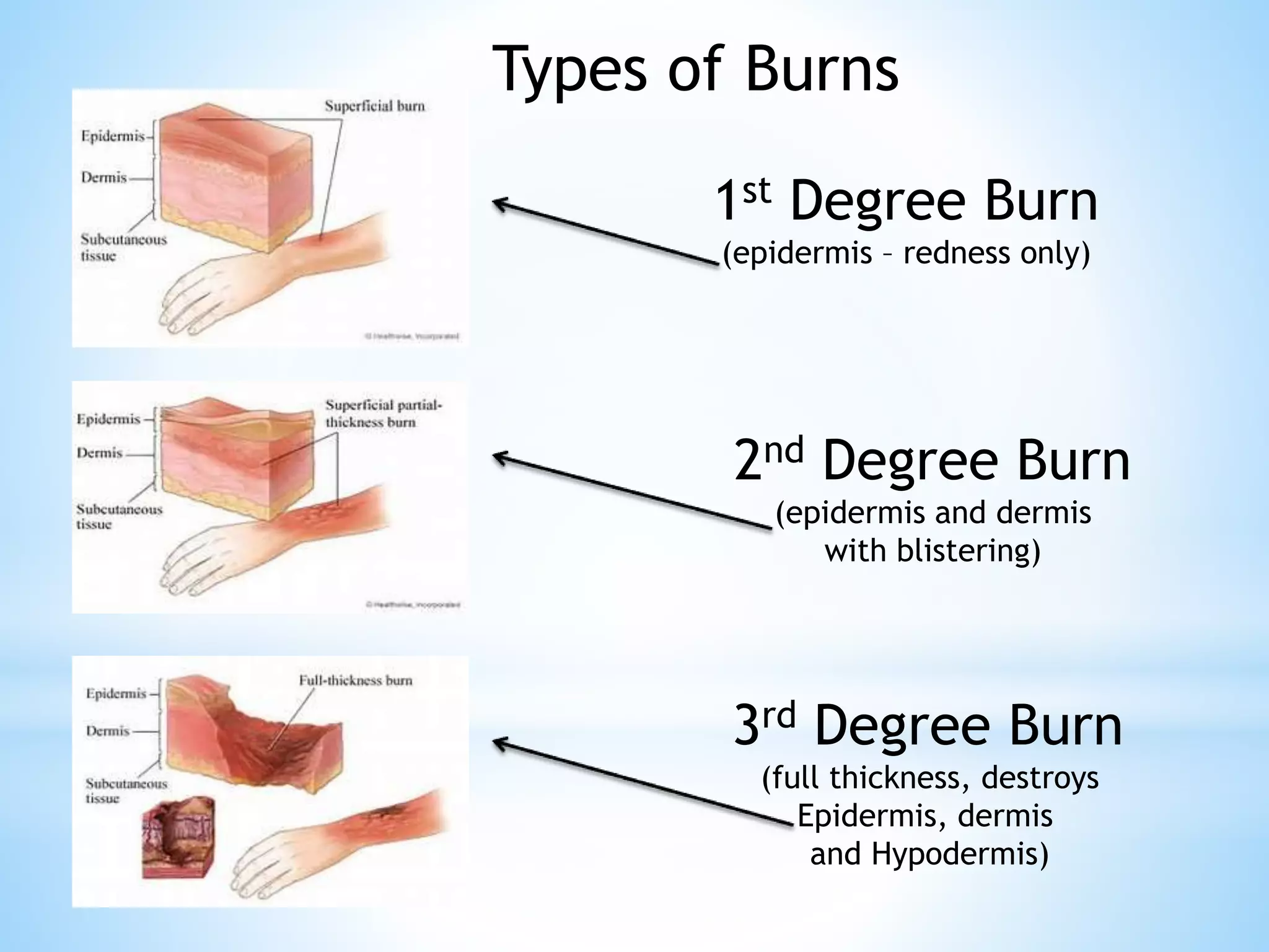 The Integumentary System | PPTX
