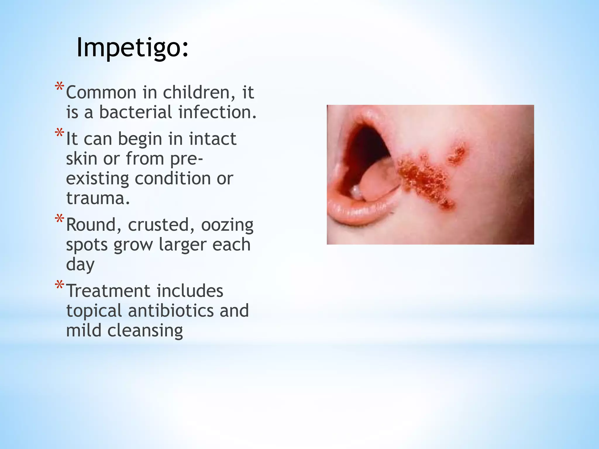 The Integumentary System | PPTX