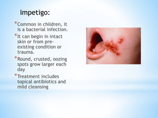 The Integumentary System | PPTX