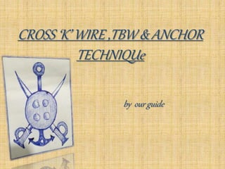 T y elbow treatment by cross k wire technique | PPT
