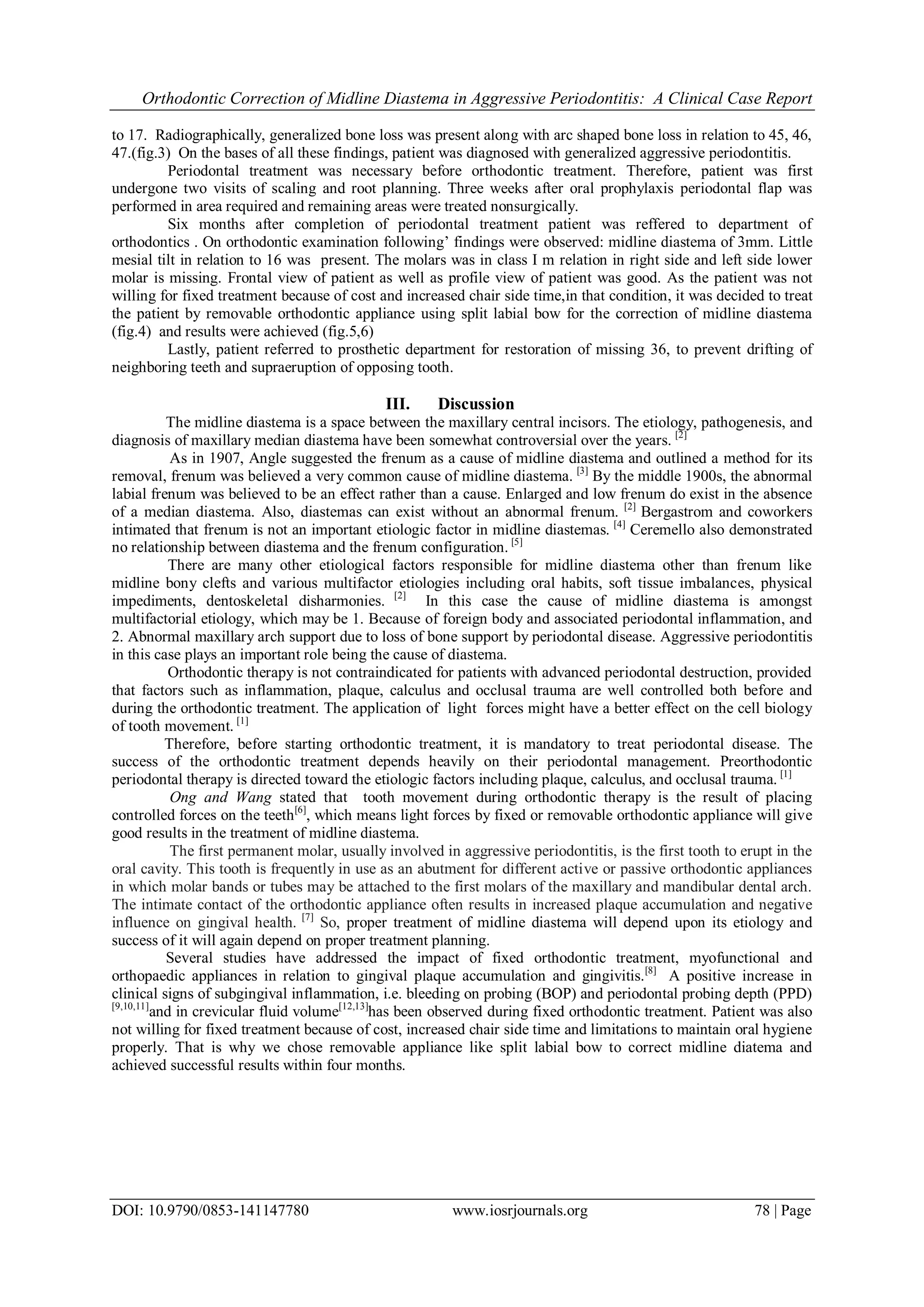 Orthodontic Correction of Midline Diastema in Aggressive Periodontitis ...